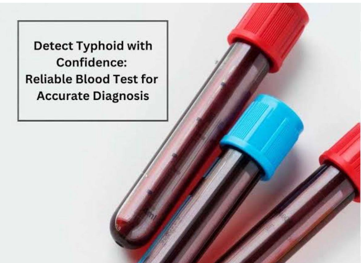 Conflict of interest deepens as few doctors prescribing banned Typhidot ...