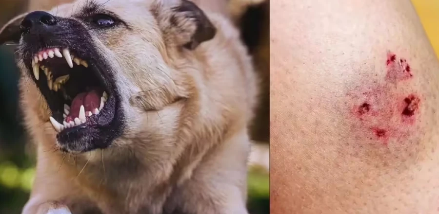 Larkana man dies of rabies, Sindh death toll rises to 14 this year ...